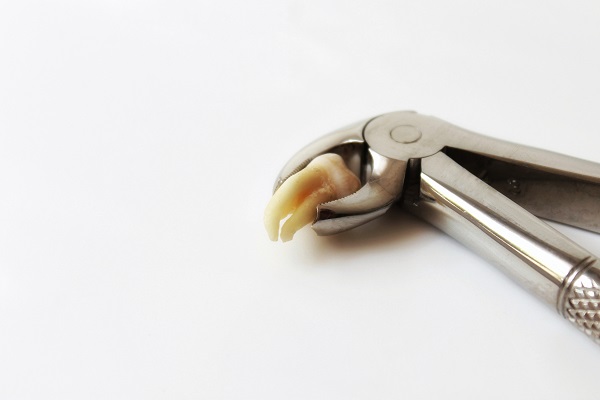 Tooth Extraction Healing: What's the White Stuff?